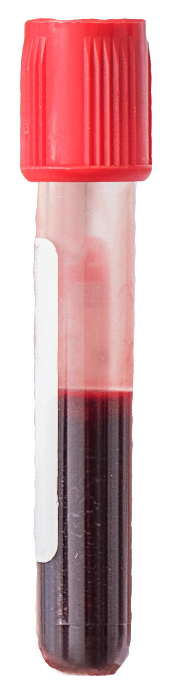 Genomic Analysis with DNA from Saliva instead of blood - Isohelix